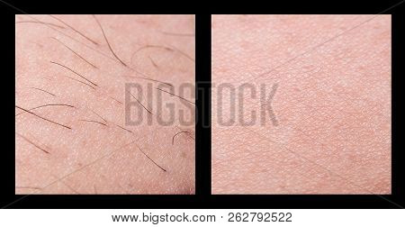 Depilation Sugaring. Image & Photo (Free Trial) | Bigstock