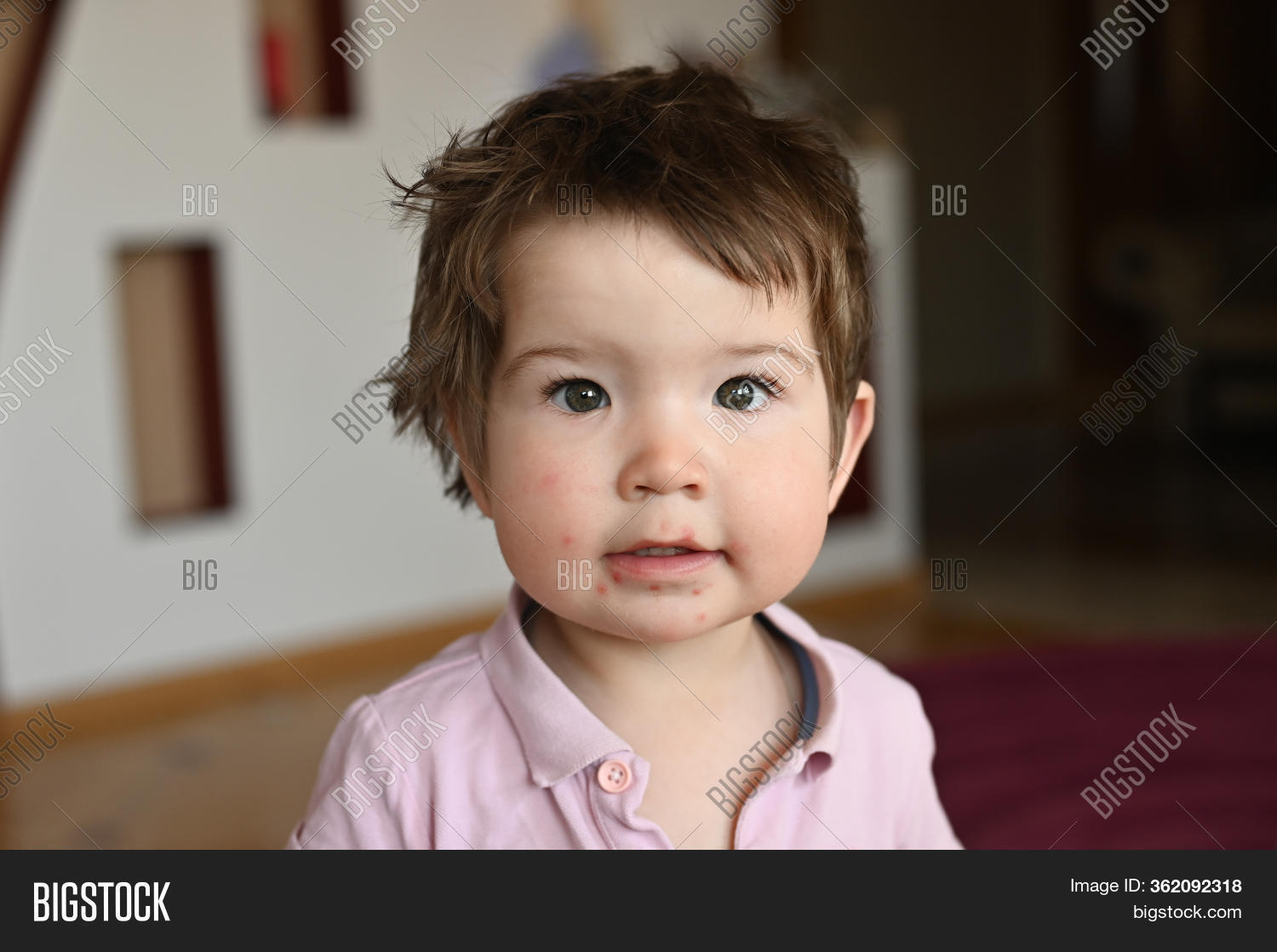 Herpes Child. Child Image & Photo (Free Trial) | Bigstock