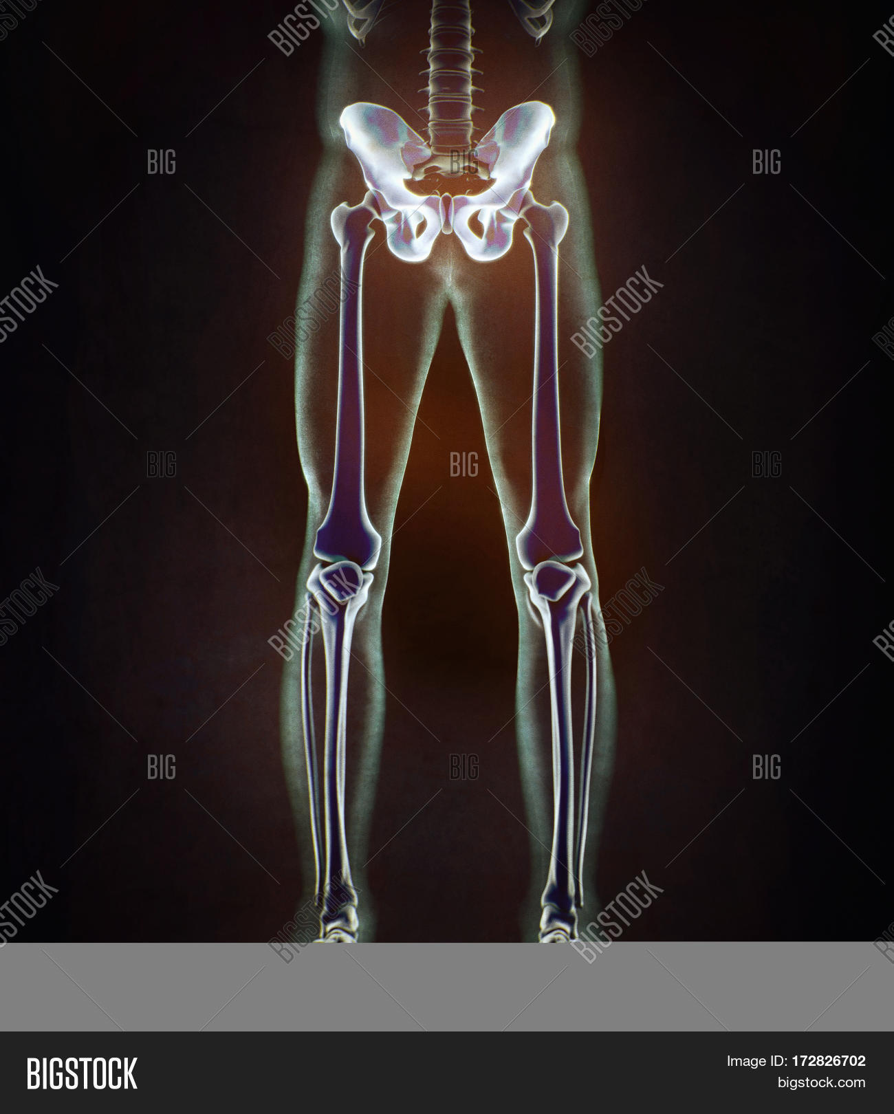 Ilium Bone, Hip Bone Image & Photo (Free Trial) | Bigstock