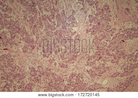 Cells Human Breast Image & Photo (Free Trial) | Bigstock