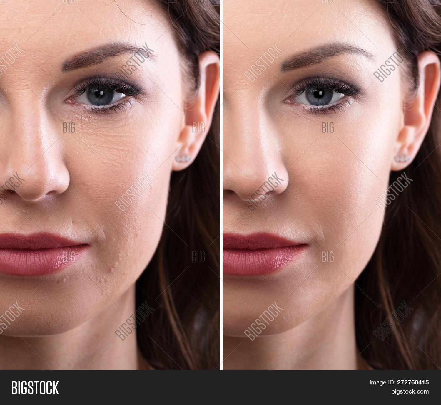 Woman's Face Before Image & Photo (Free Trial) | Bigstock