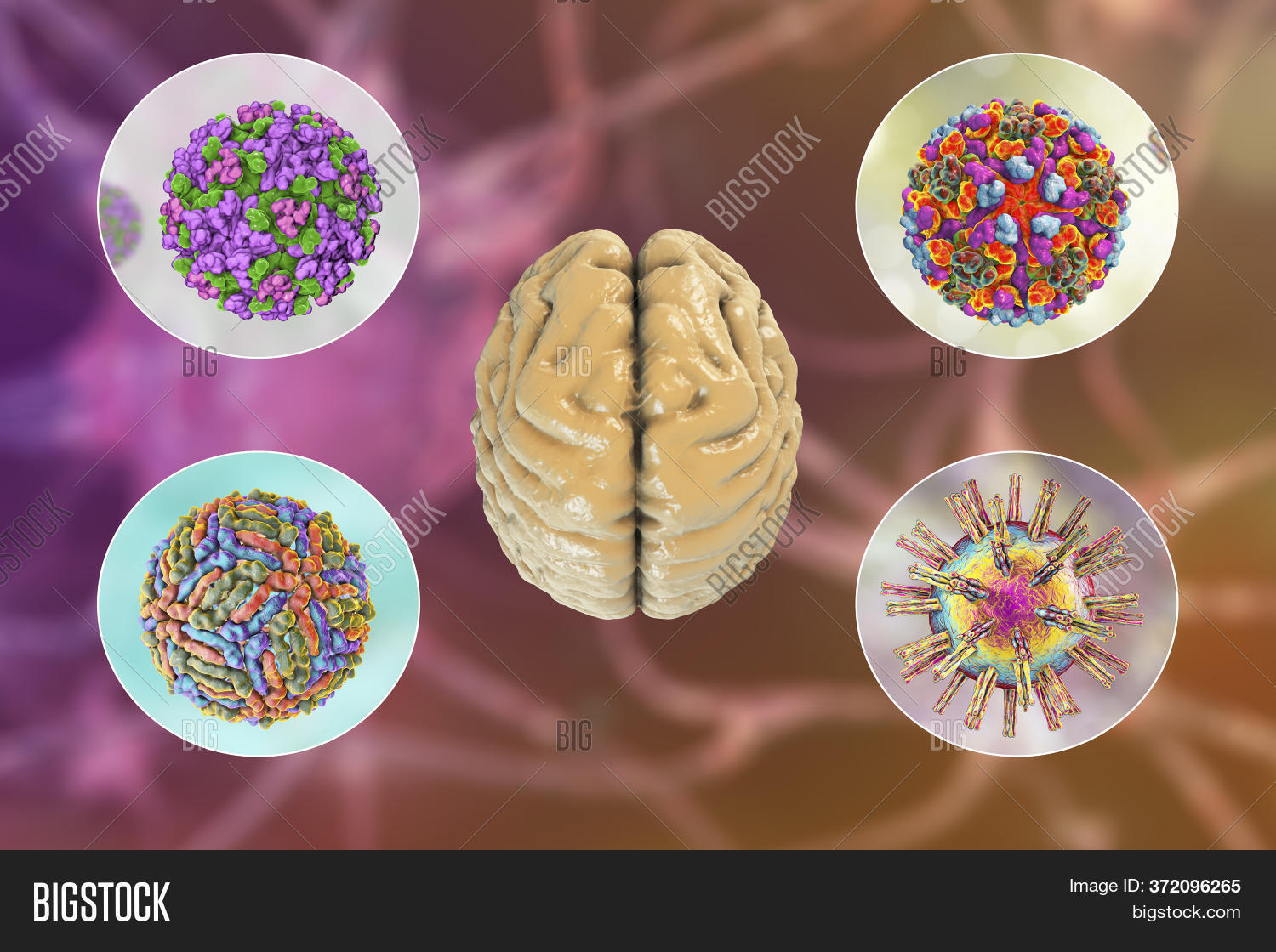 Brain Infections, Image & Photo (Free Trial) | Bigstock
