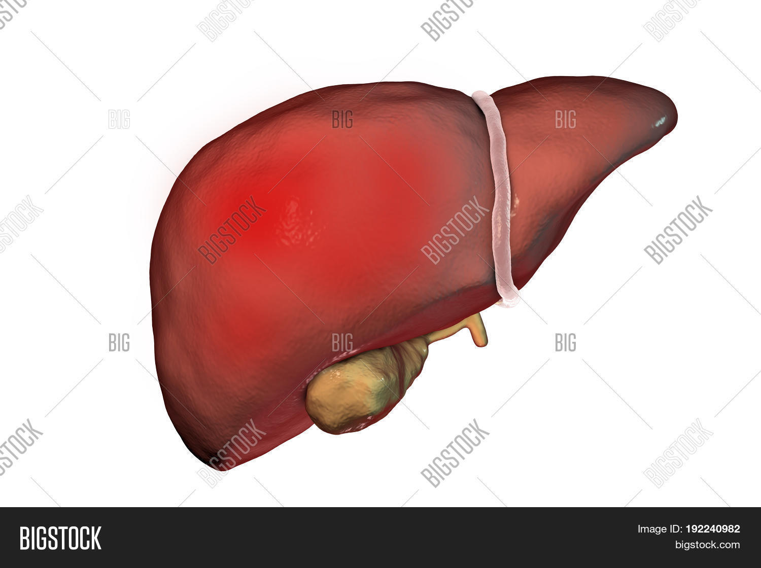 Liver Hepatitis. Liver Image & Photo (Free Trial) | Bigstock