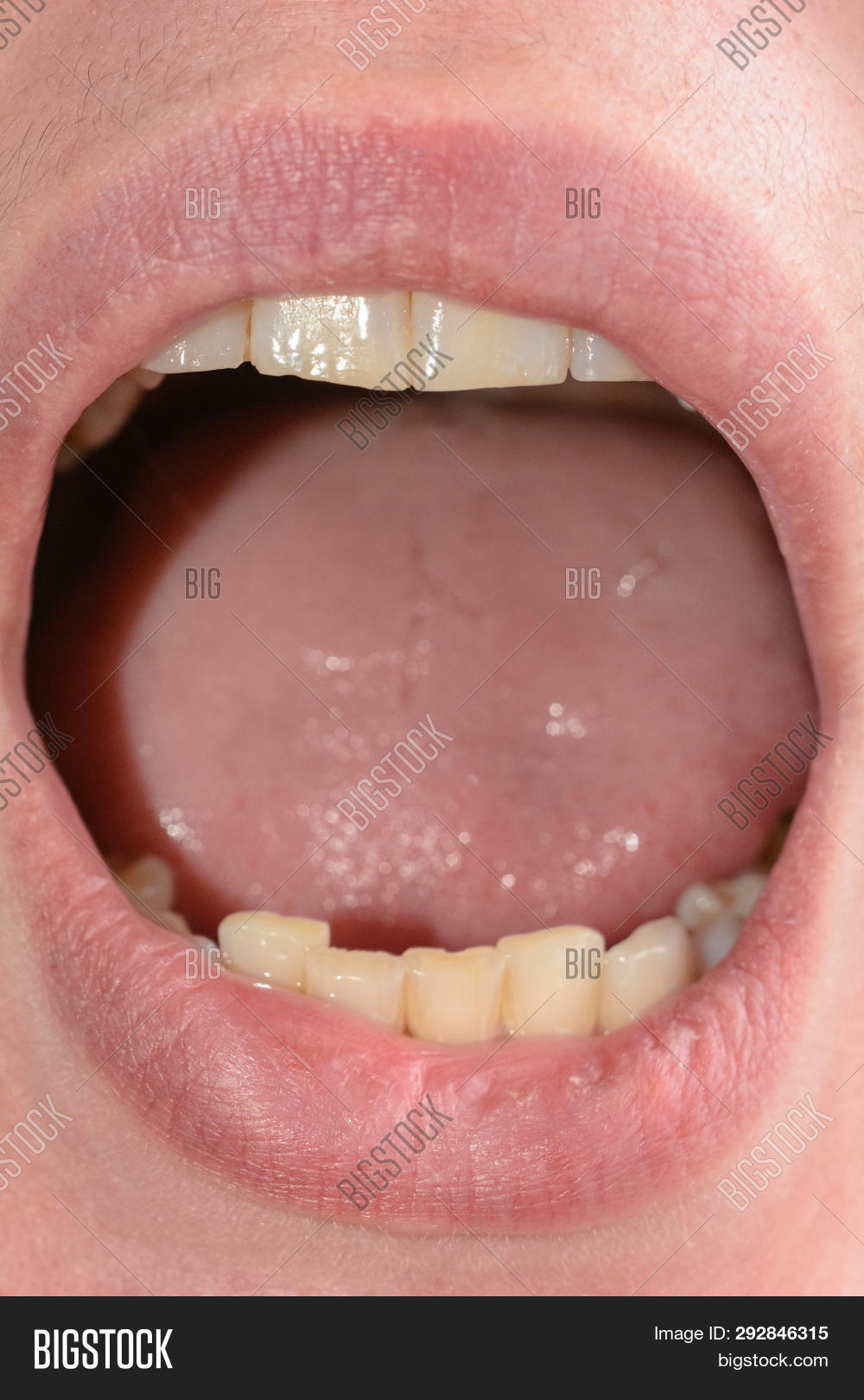 Woman Opened Her Mouth Image & Photo (Free Trial) | Bigstock