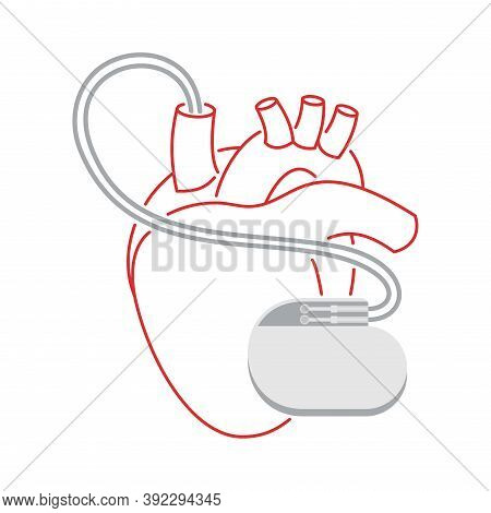 Pacemaker Thin Line Vector & Photo (Free Trial) | Bigstock