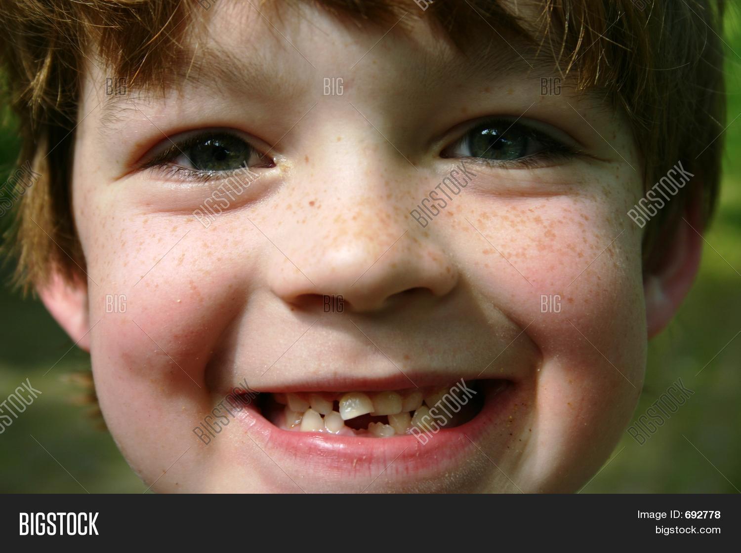 Snaggle Tooth Boy Image & Photo (Free Trial) | Bigstock