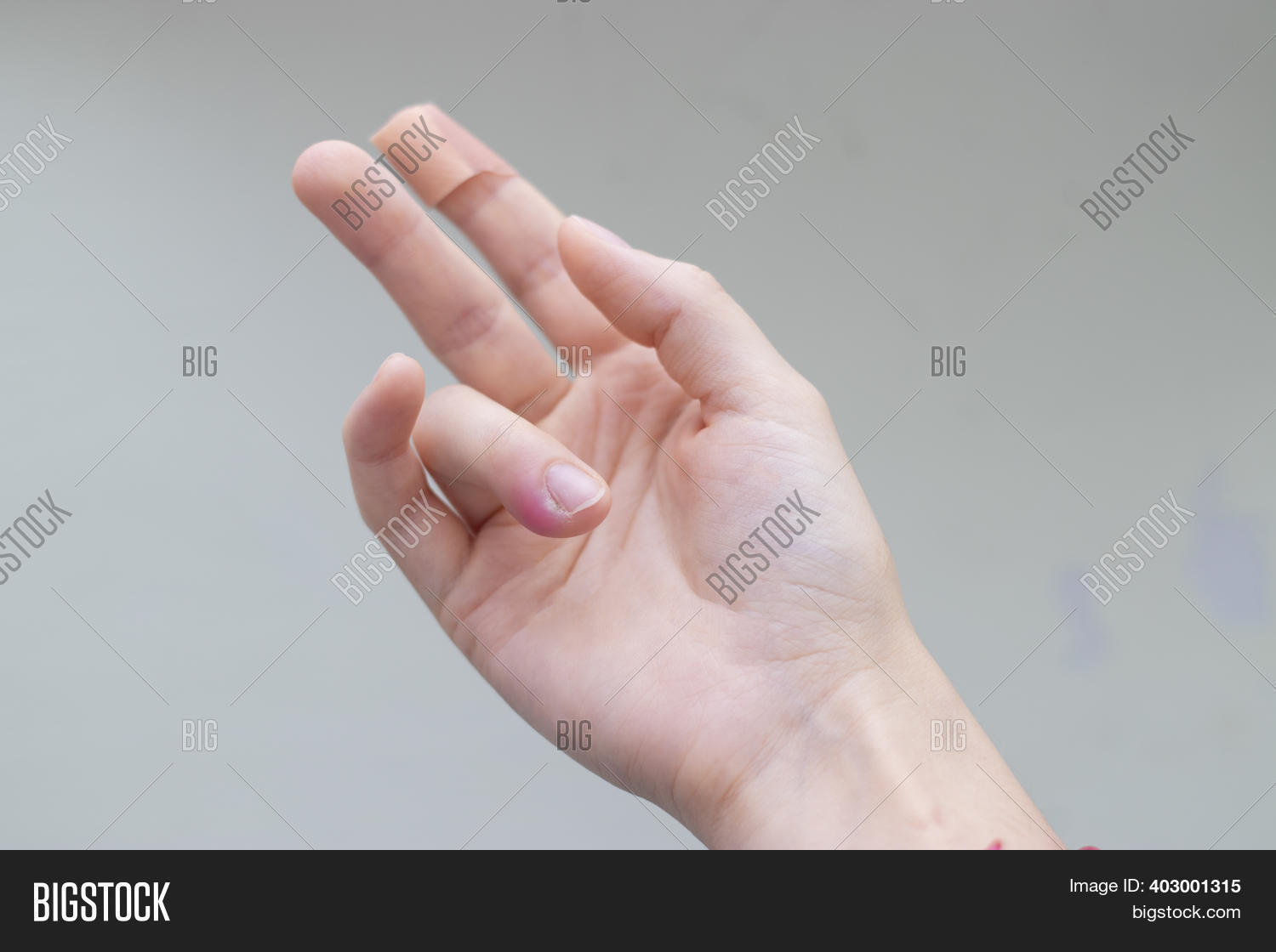 Abscess On Finger. Image & Photo (Free Trial) | Bigstock
