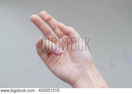 Abscess On Finger. Image & Photo (Free Trial) | Bigstock