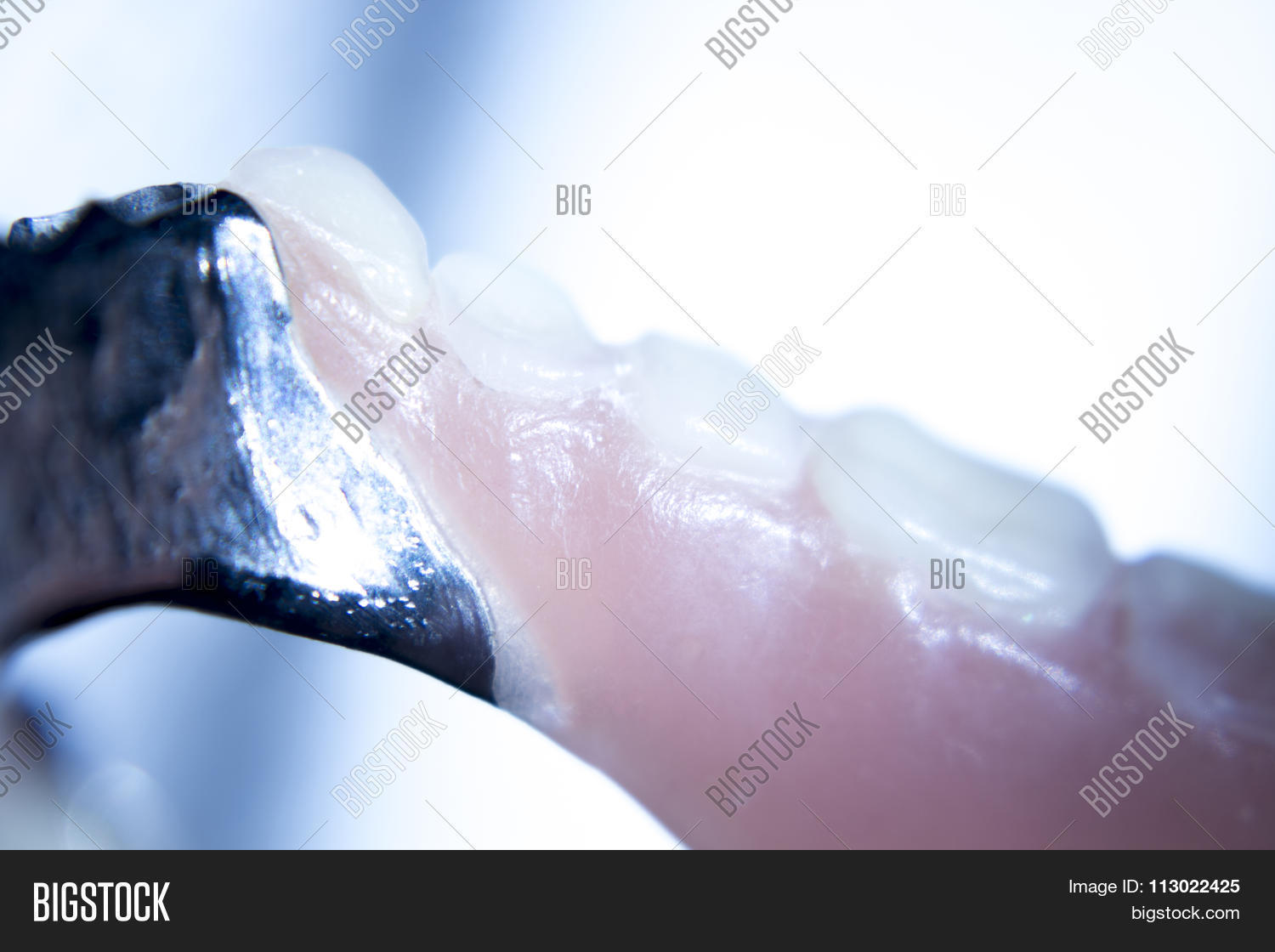 Prosthetic Dental Image & Photo (Free Trial) | Bigstock