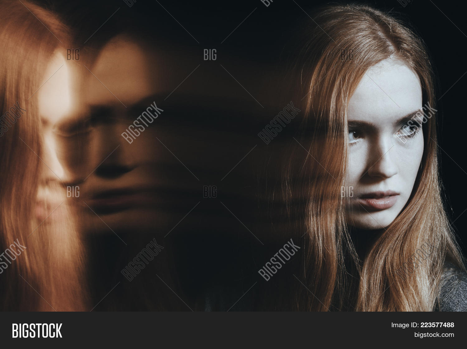 Young Girl Bipolar Image & Photo (Free Trial) | Bigstock