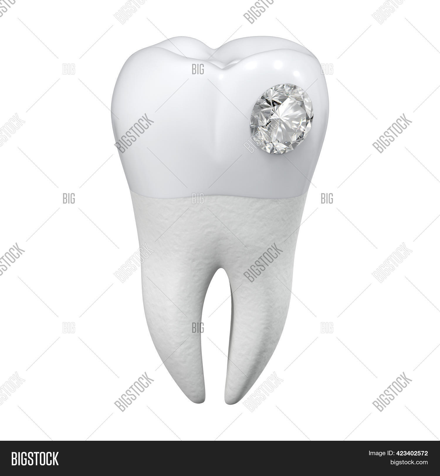 Large Molar Tooth Image & Photo (Free Trial) | Bigstock
