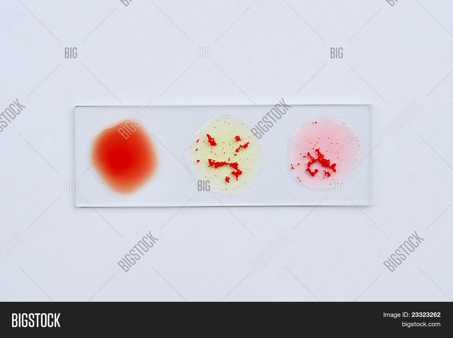 Blood Slide Image & Photo (Free Trial) | Bigstock