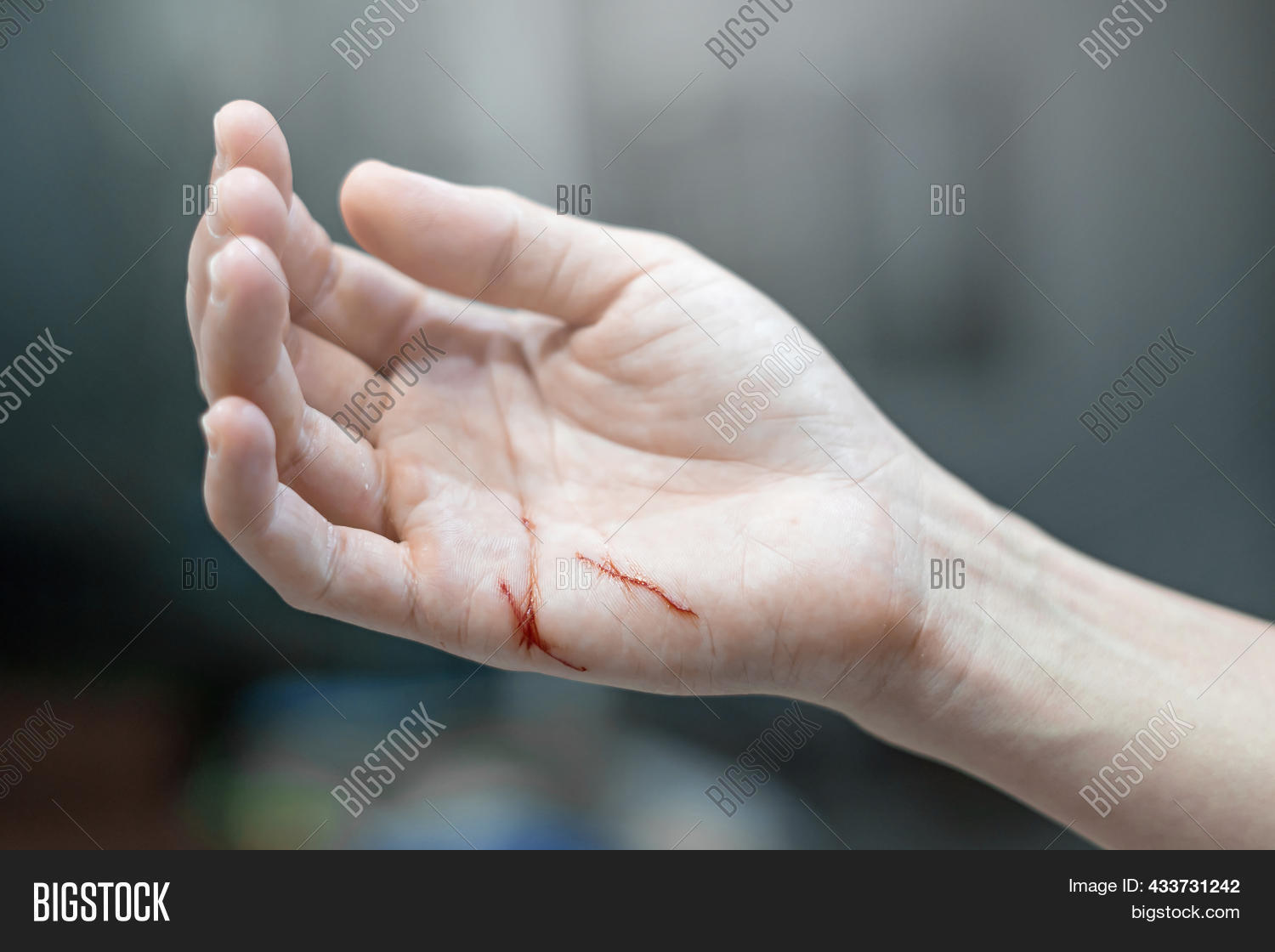 Close Wound Women Hand Image & Photo (Free Trial) | Bigstock