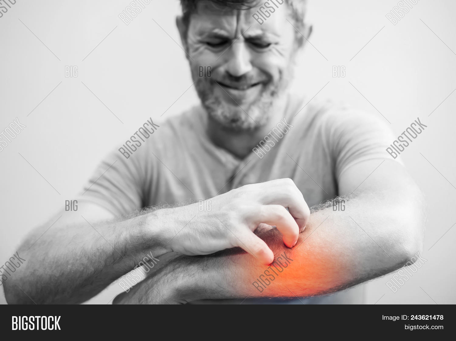 People Scratch Itch Image & Photo (Free Trial) | Bigstock