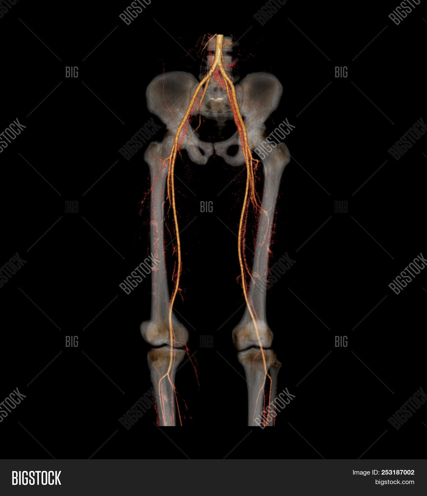 Ct Scan 2d 3d Image & Photo (Free Trial) | Bigstock