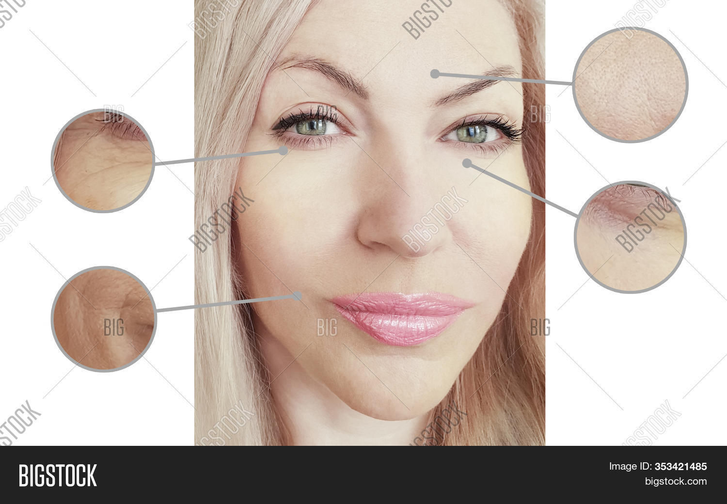 Woman Face Wrinkles Image & Photo (Free Trial) | Bigstock