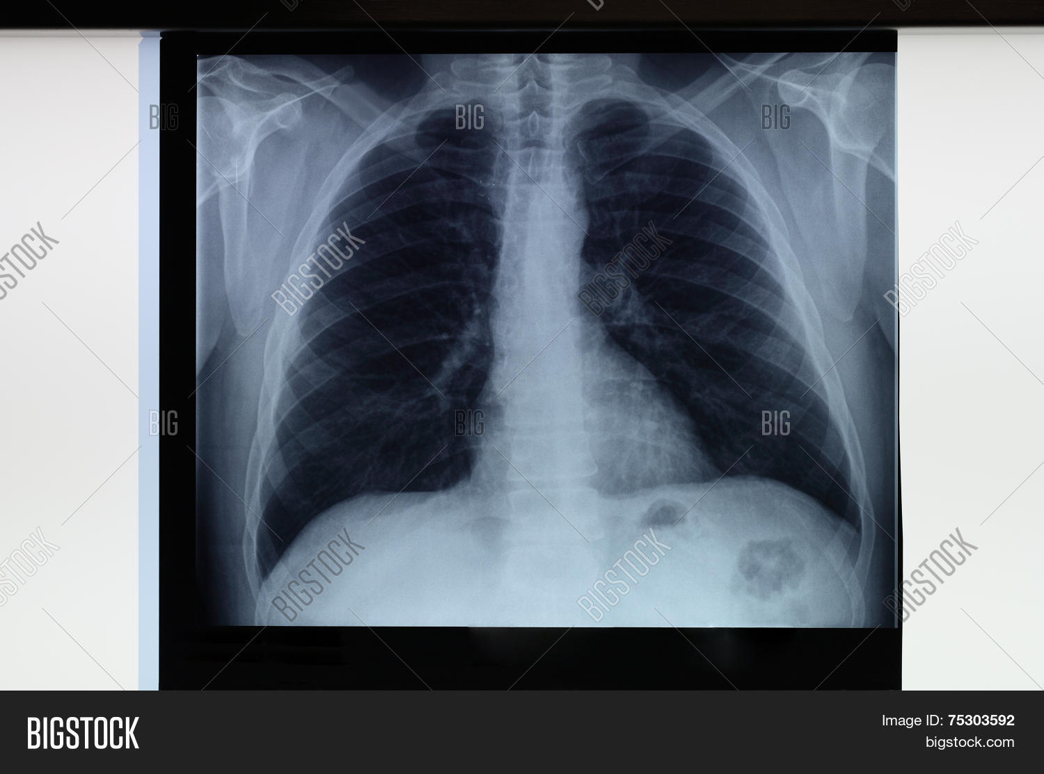 X-rays On X-ray Viewer Image & Photo (Free Trial) | Bigstock