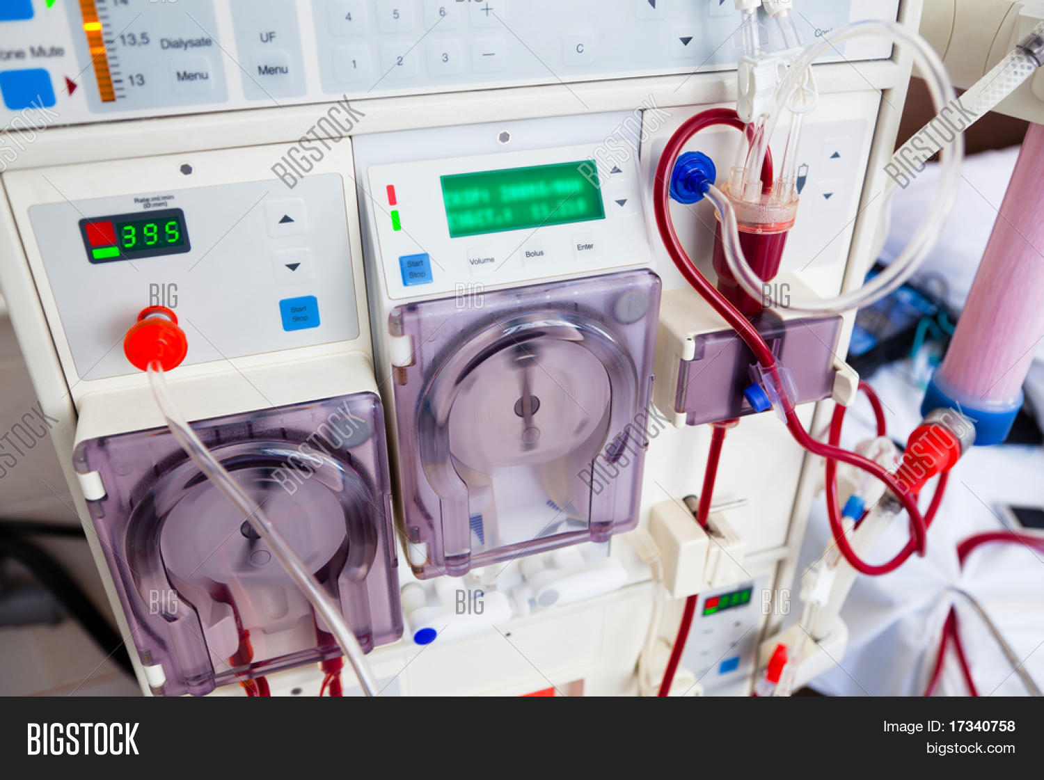 Arlificial Kidney ( Image & Photo (Free Trial) | Bigstock