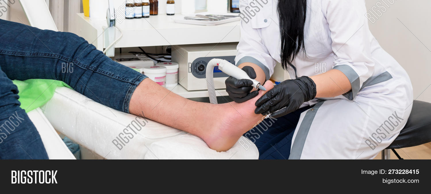 Podology Treatment. Image & Photo (Free Trial) | Bigstock