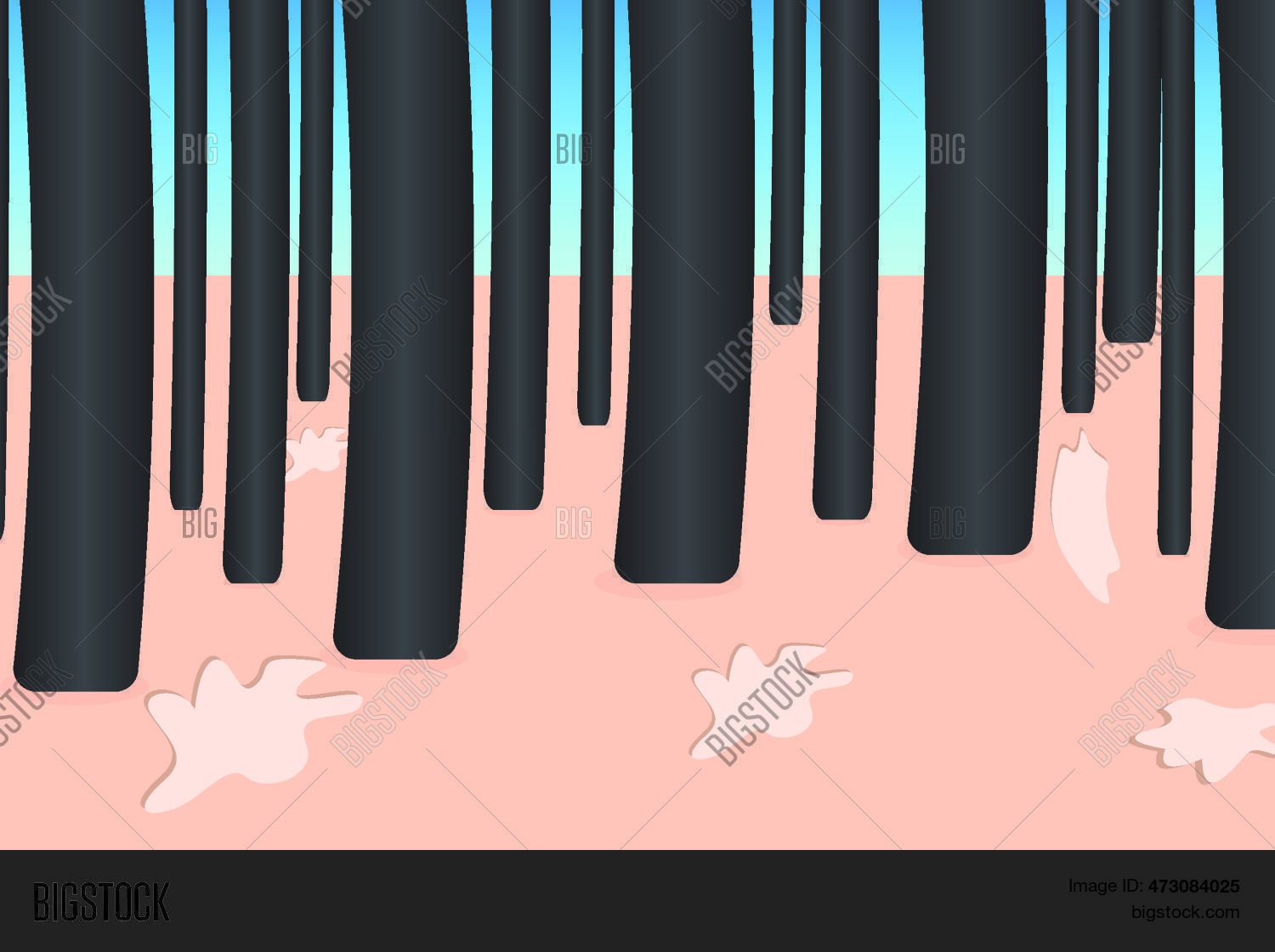 Dandruff On Head Skin Vector & Photo (Free Trial) | Bigstock