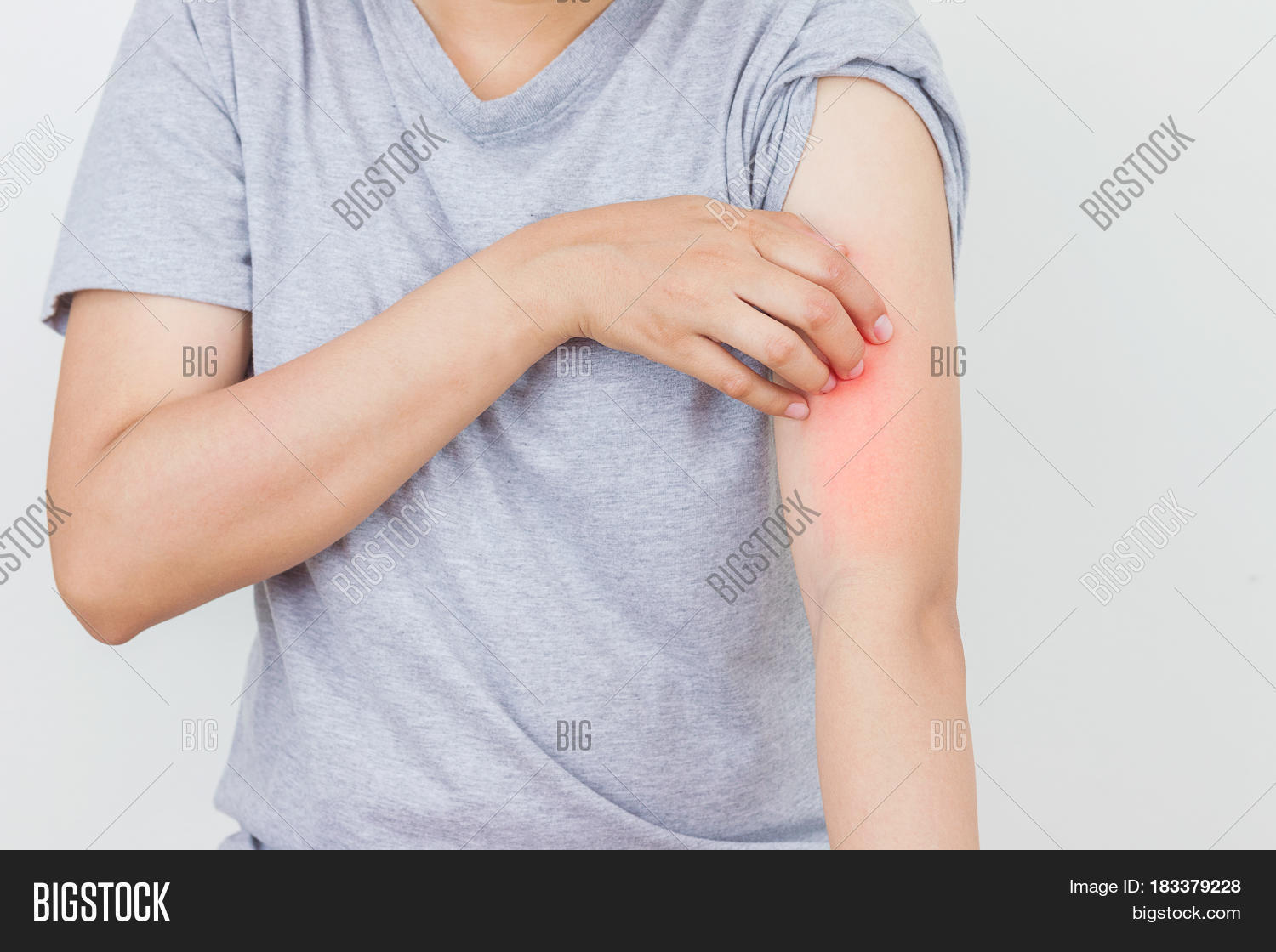 Women Scratch Itch On Image & Photo (Free Trial) | Bigstock