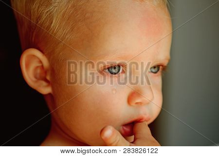 These Weepy Eyes. Image & Photo (Free Trial) | Bigstock