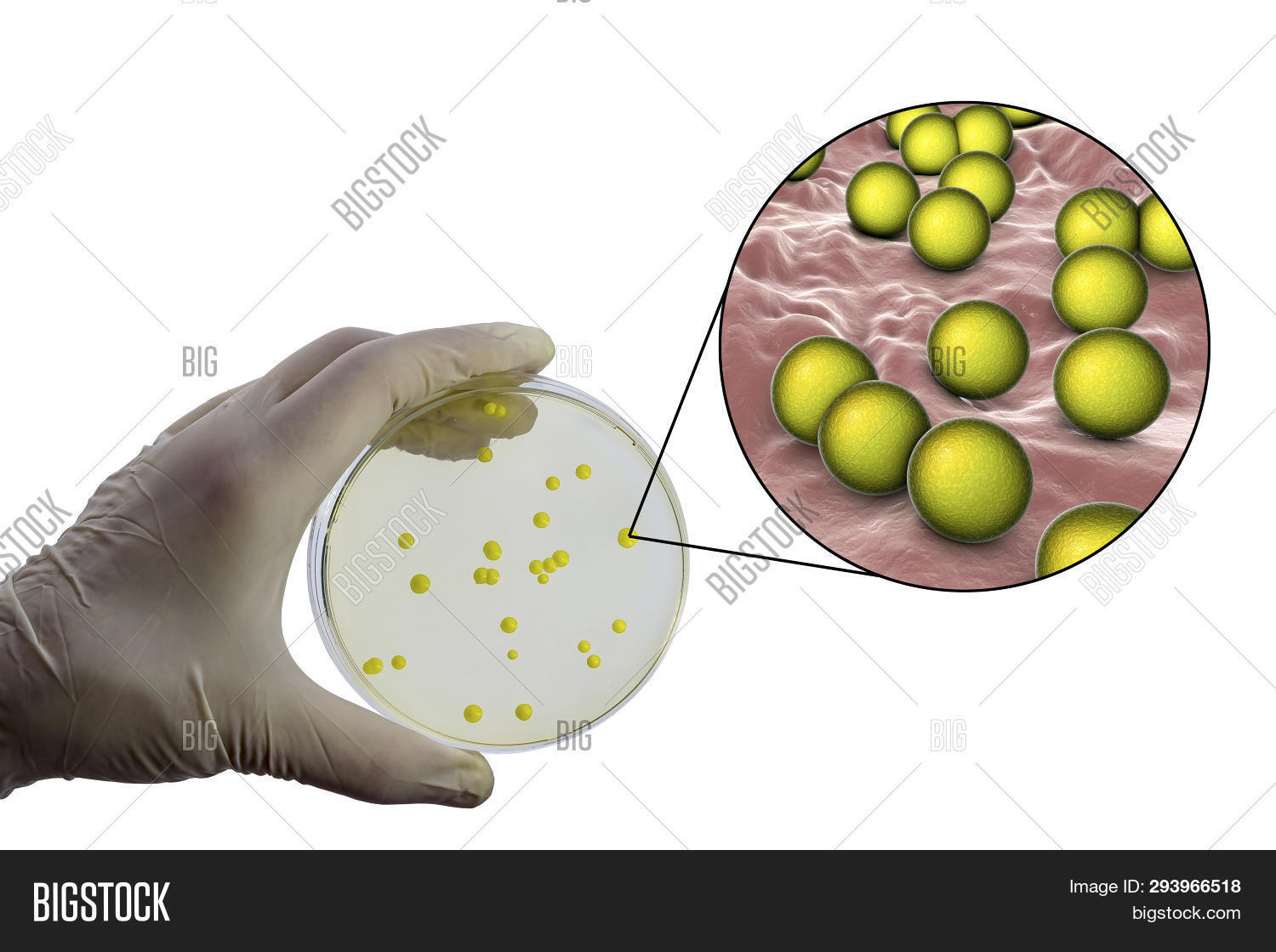 Colonies Micrococcus Image & Photo (Free Trial) | Bigstock
