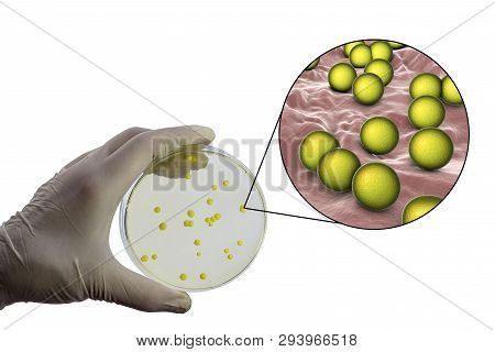 Colonies Micrococcus Image & Photo (Free Trial) | Bigstock