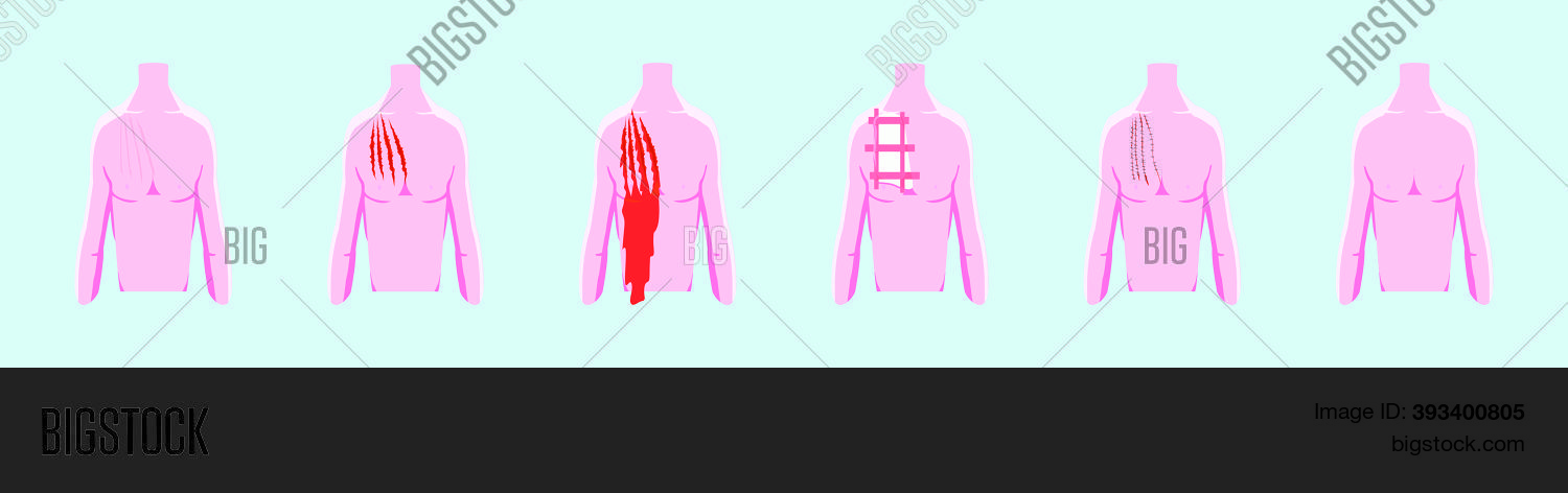 Set Scar, Wound, Vector & Photo (Free Trial) | Bigstock