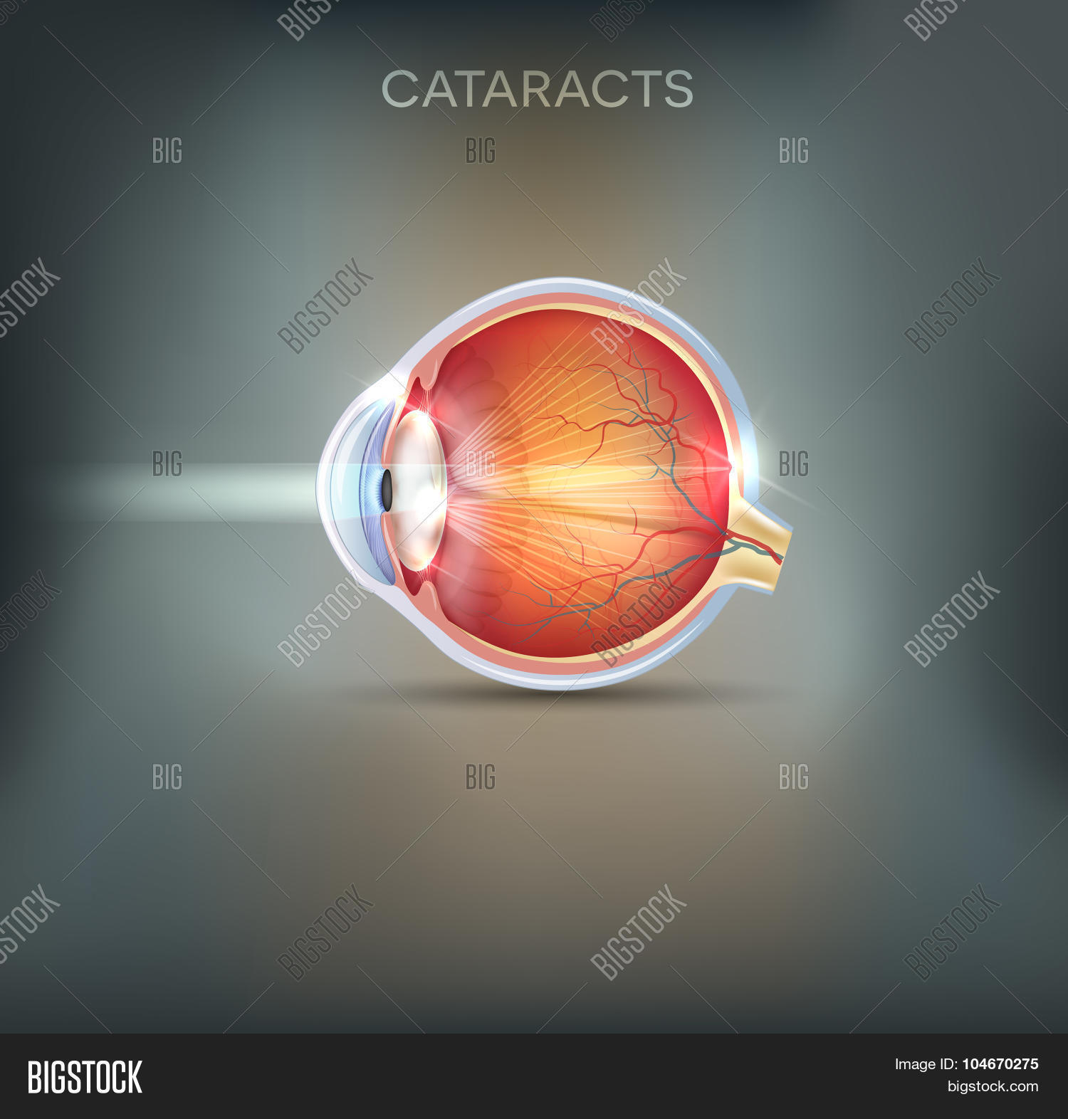 Cataracts Abstract Vector & Photo (Free Trial) | Bigstock