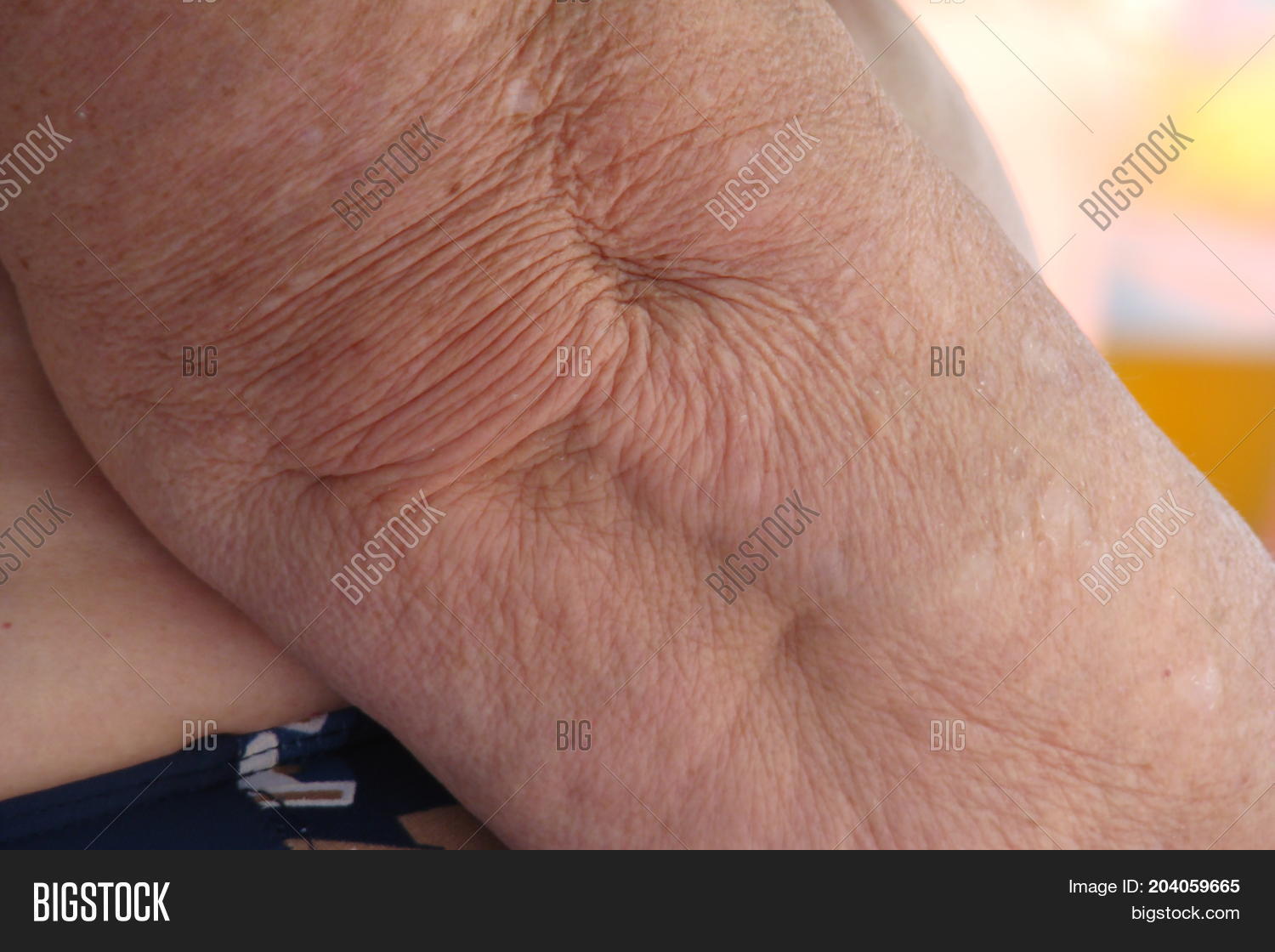 Human Aging Sagging Image & Photo (Free Trial) | Bigstock