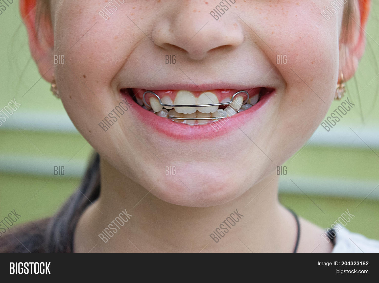 Portrait Young Teen Image & Photo (Free Trial) | Bigstock