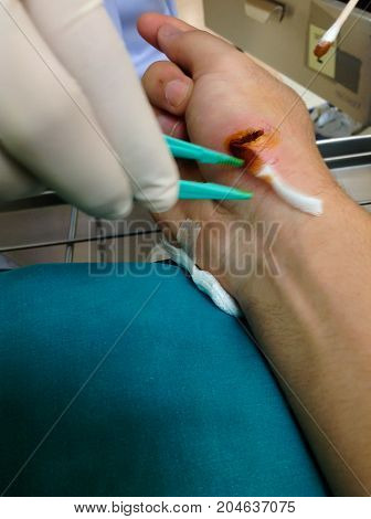 Dog Bite Fresh Image & Photo (Free Trial) | Bigstock
