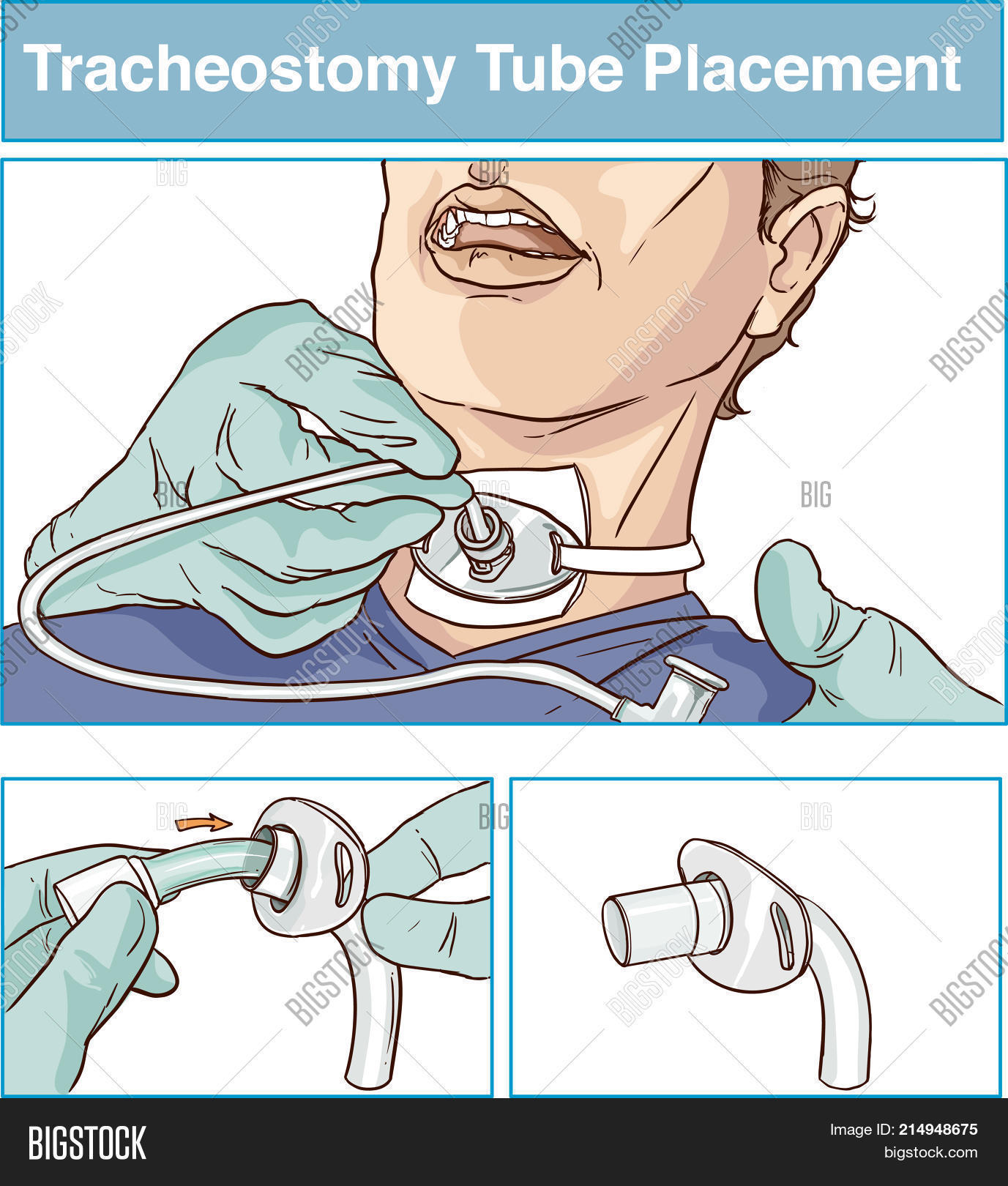 Vector Illustration Image & Photo (Free Trial) | Bigstock