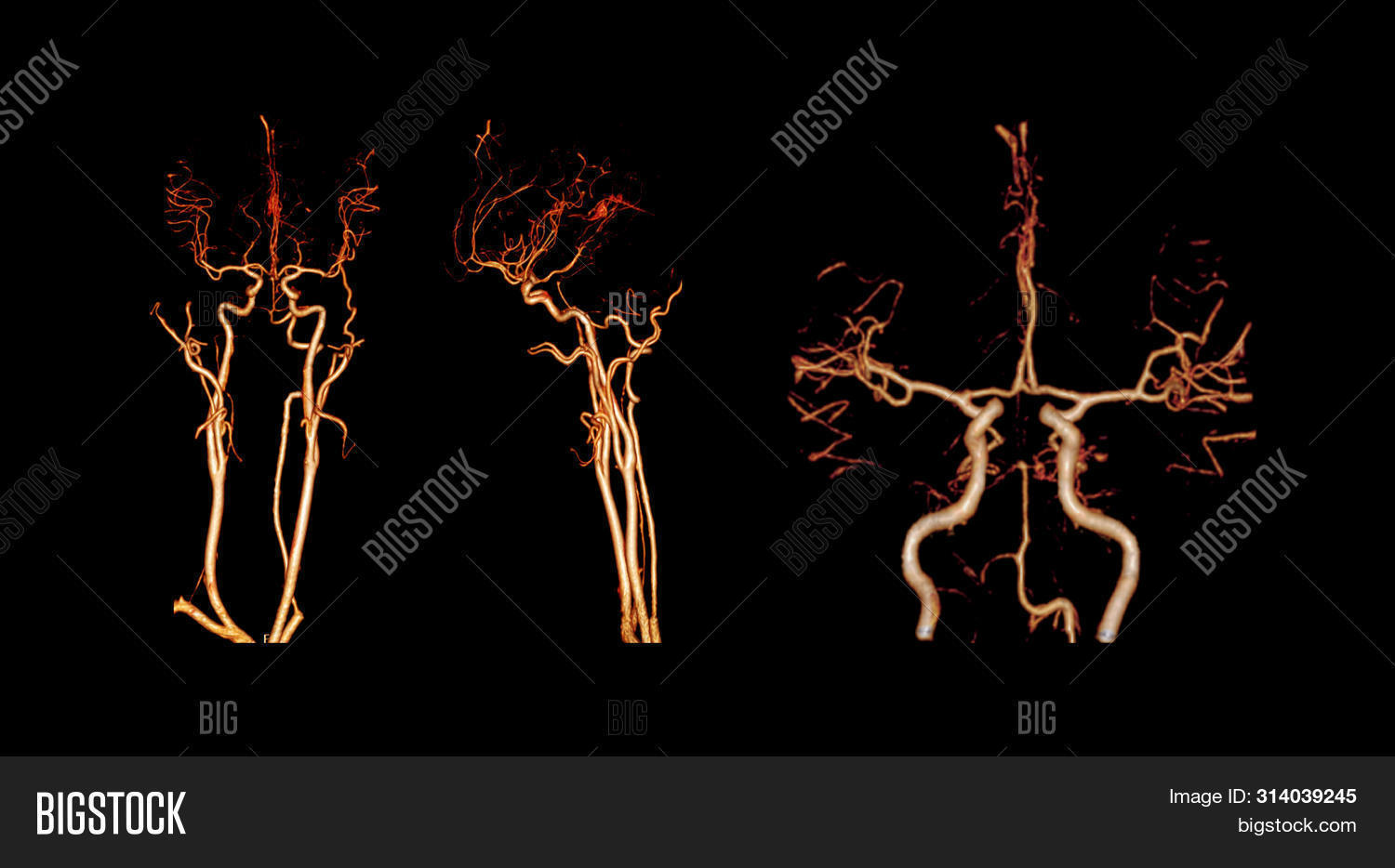 Cta Brain Os Ct Image & Photo (Free Trial) | Bigstock