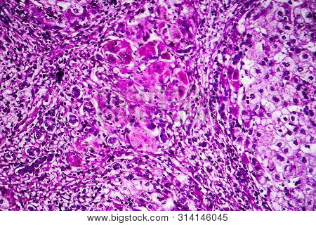 Histopathology Portal Image & Photo (Free Trial) | Bigstock