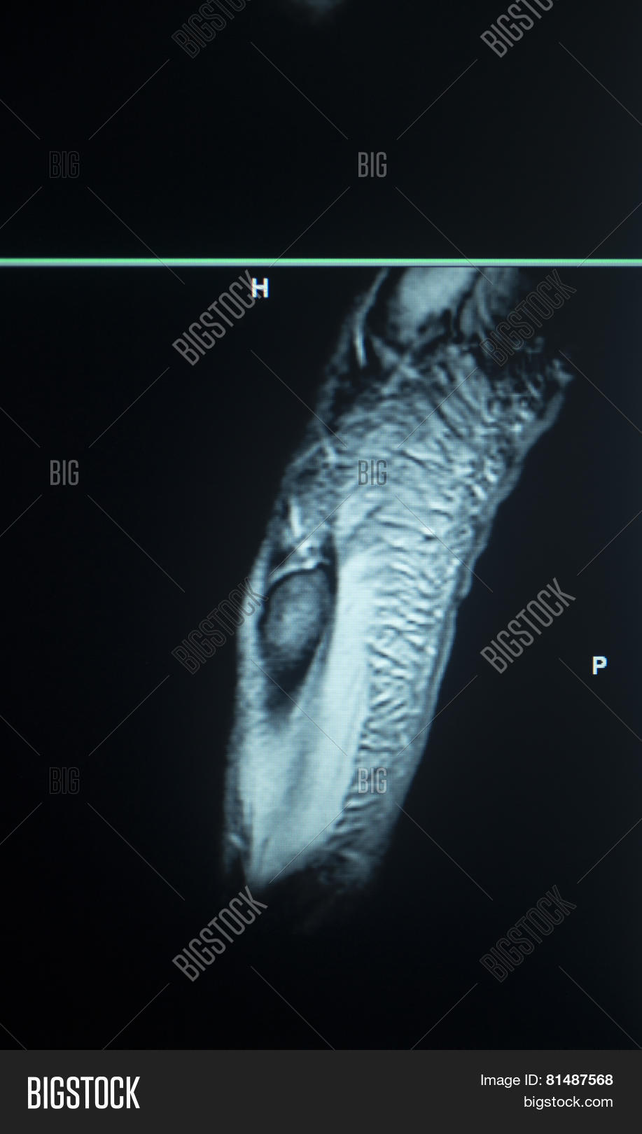 Mri Scan Test Results Image & Photo (Free Trial) | Bigstock