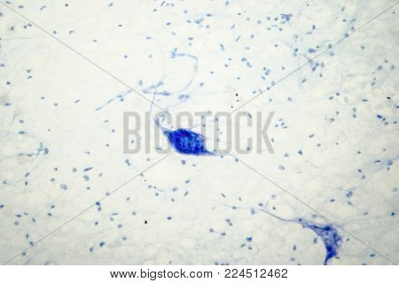 Histology Human Brain Image & Photo (Free Trial) | Bigstock