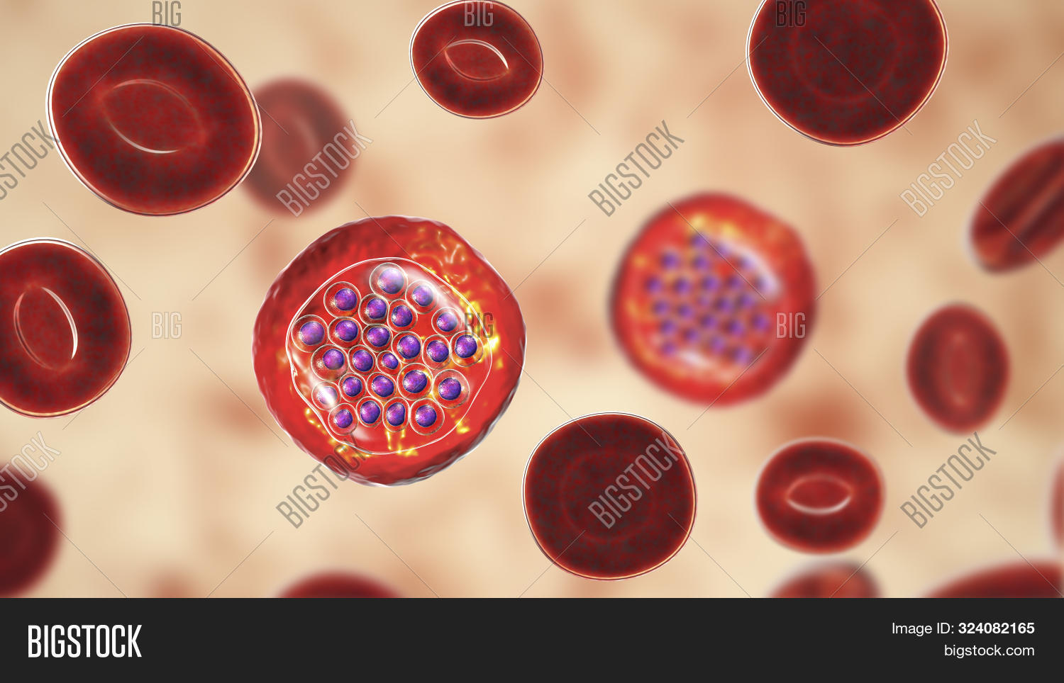 Malaria-infected Red Image & Photo (Free Trial) | Bigstock