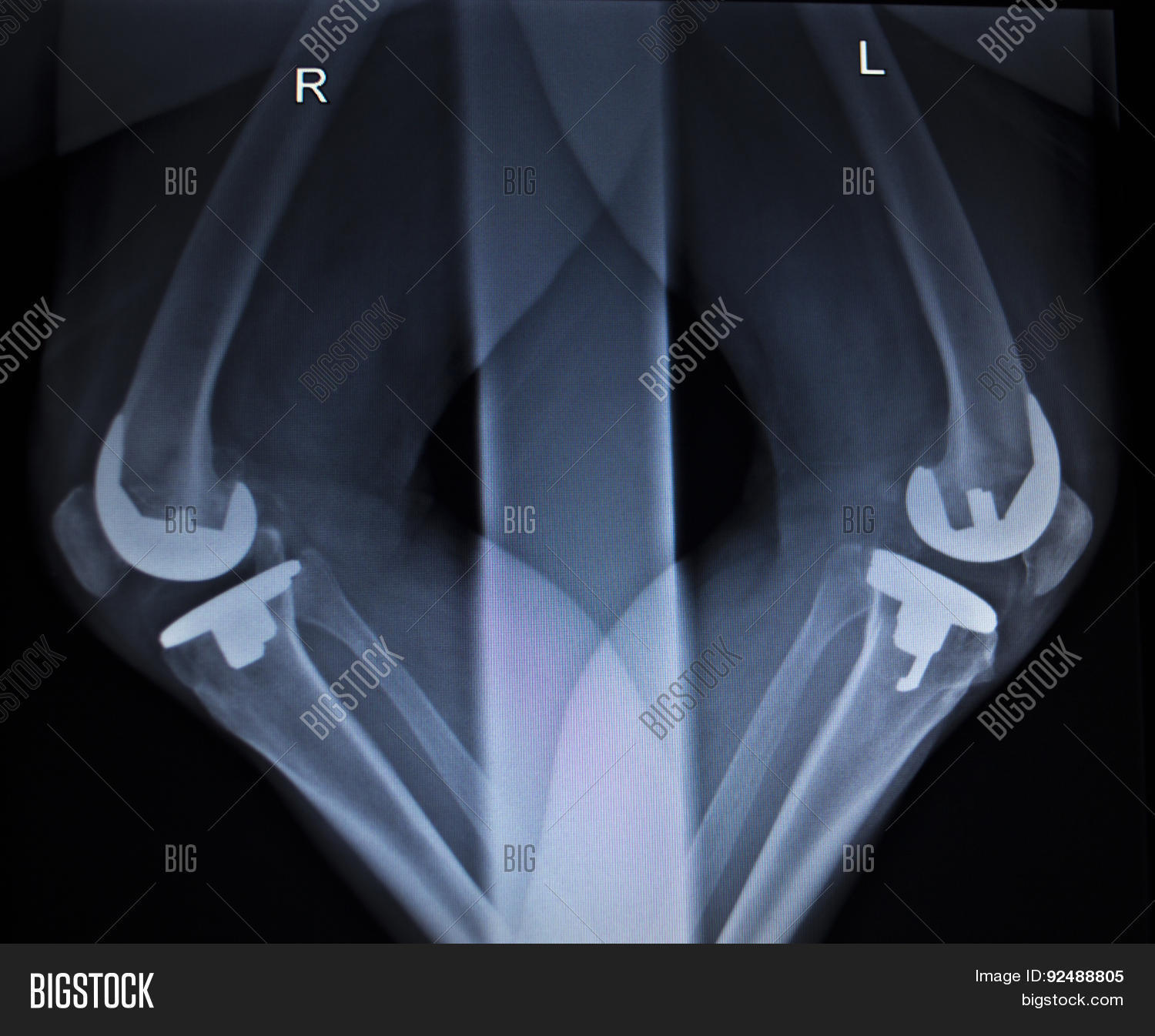X-ray Orthopedics Scan Image & Photo (Free Trial) | Bigstock