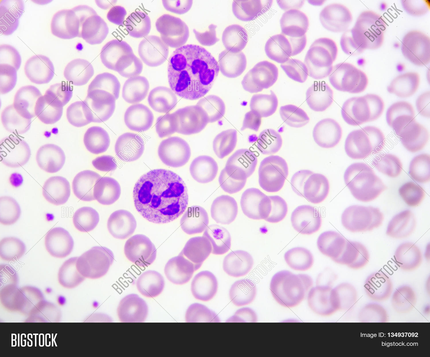 White Blood Cell Image & Photo (Free Trial) | Bigstock