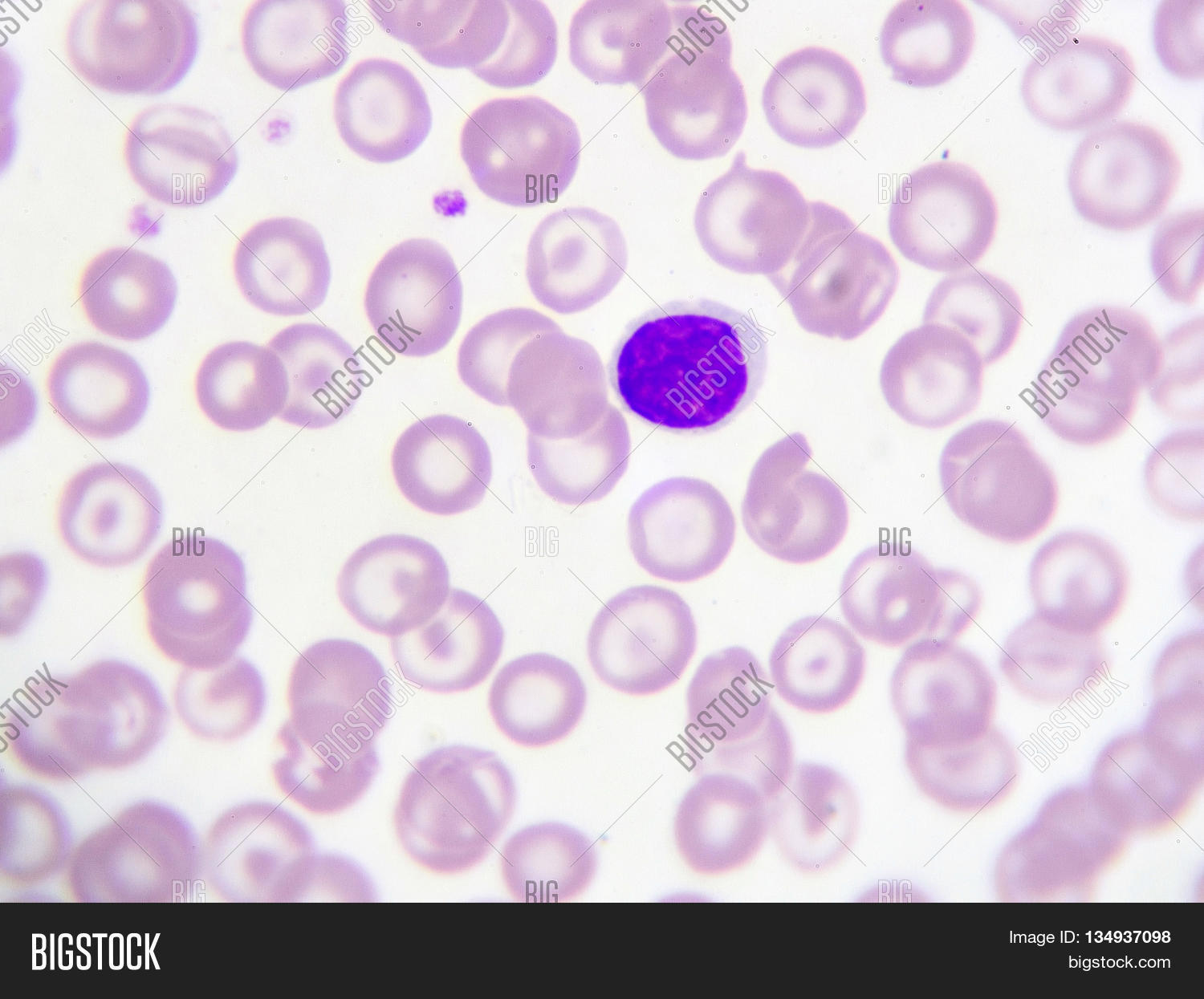 White Blood Cell Image & Photo (Free Trial) | Bigstock
