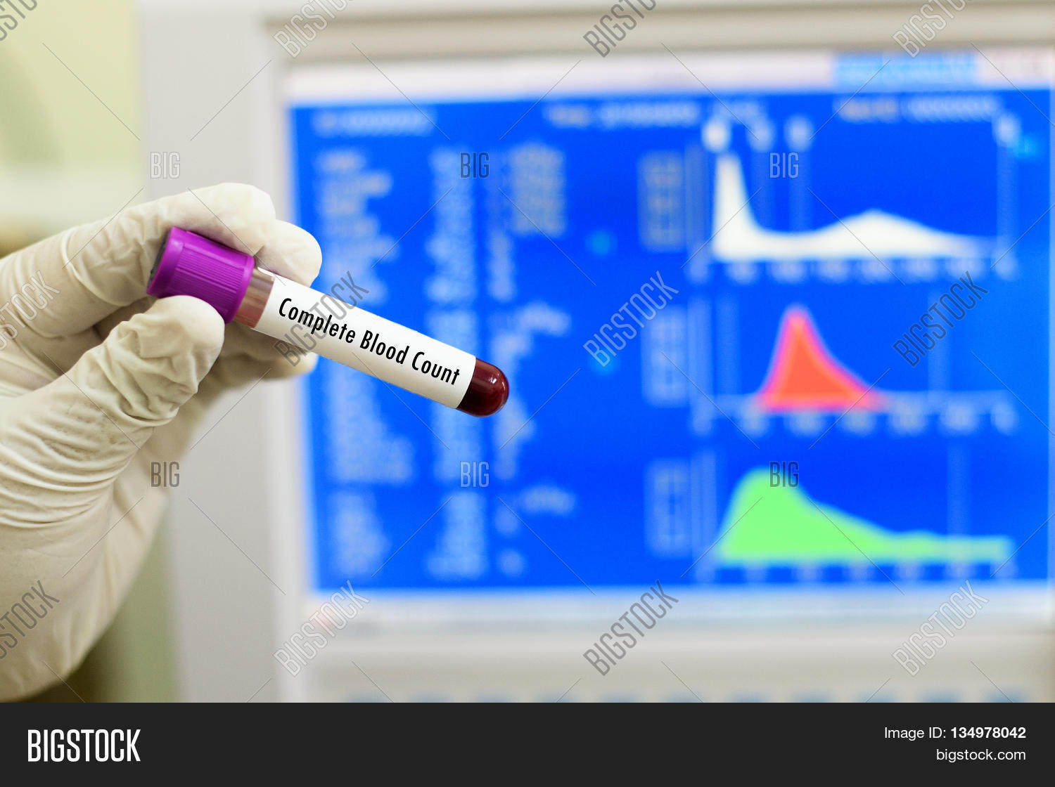Blood Sample Complete Image & Photo (Free Trial) | Bigstock
