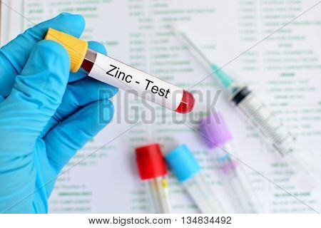 Test Tube Blood Sample Image & Photo (Free Trial) | Bigstock