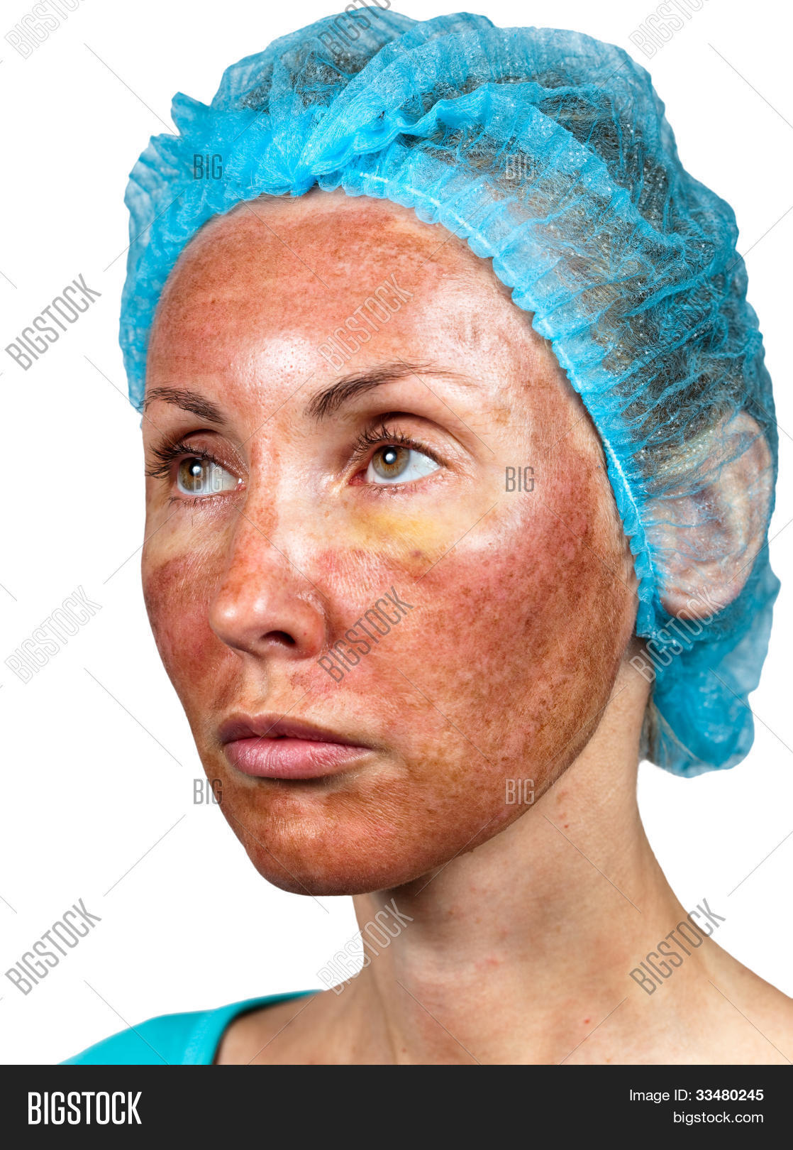 Cosmetology. Skin Image & Photo (Free Trial) | Bigstock