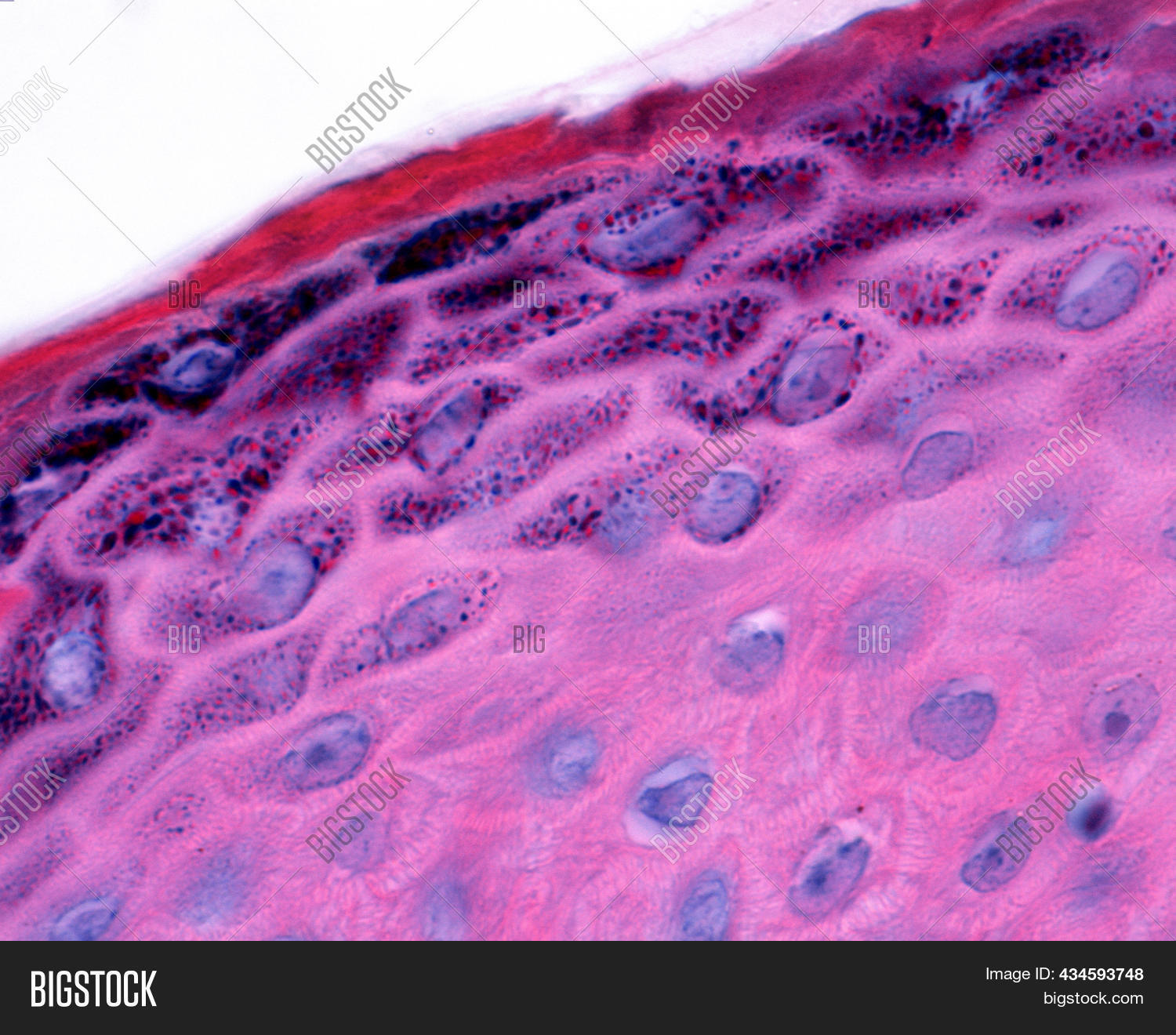 Epidermis Thin Skin. Image & Photo (Free Trial) | Bigstock