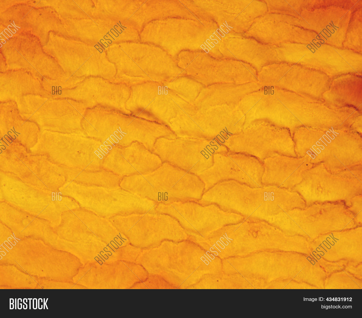 Silver Stain Methods Image & Photo (Free Trial) | Bigstock