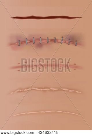 Set Healing Wounds, Image & Photo (Free Trial) | Bigstock