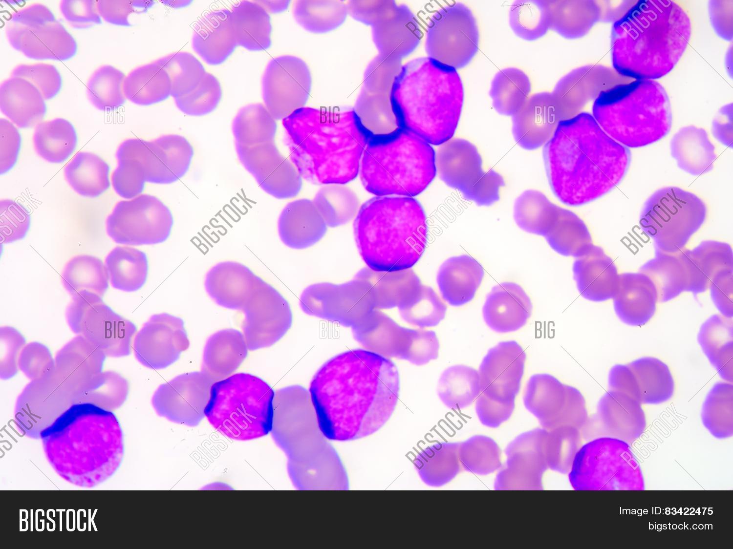 Precursor Cell On Image & Photo (Free Trial) | Bigstock