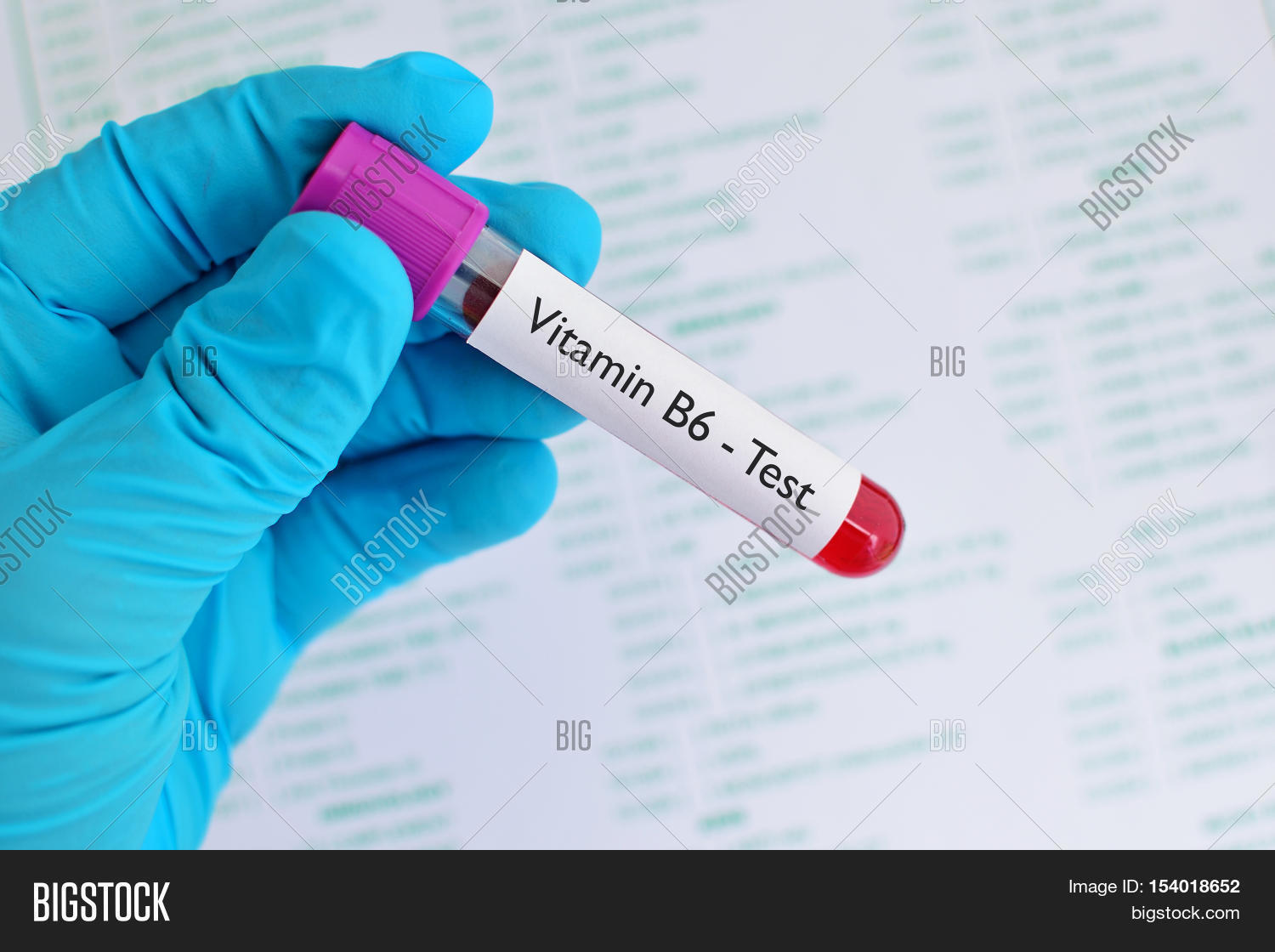 Test Tube Blood Sample Image & Photo (Free Trial) | Bigstock